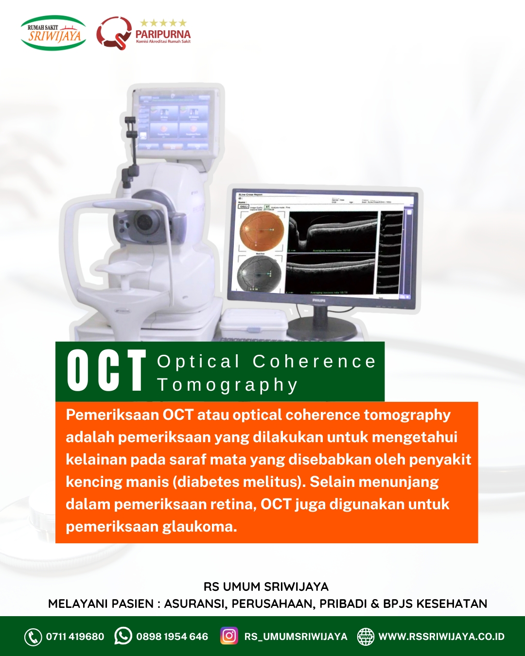 Pemeriksaan OCT (Optical Coherence Tomography) - RUMAH SAKIT UMUM SRIWIJAYA